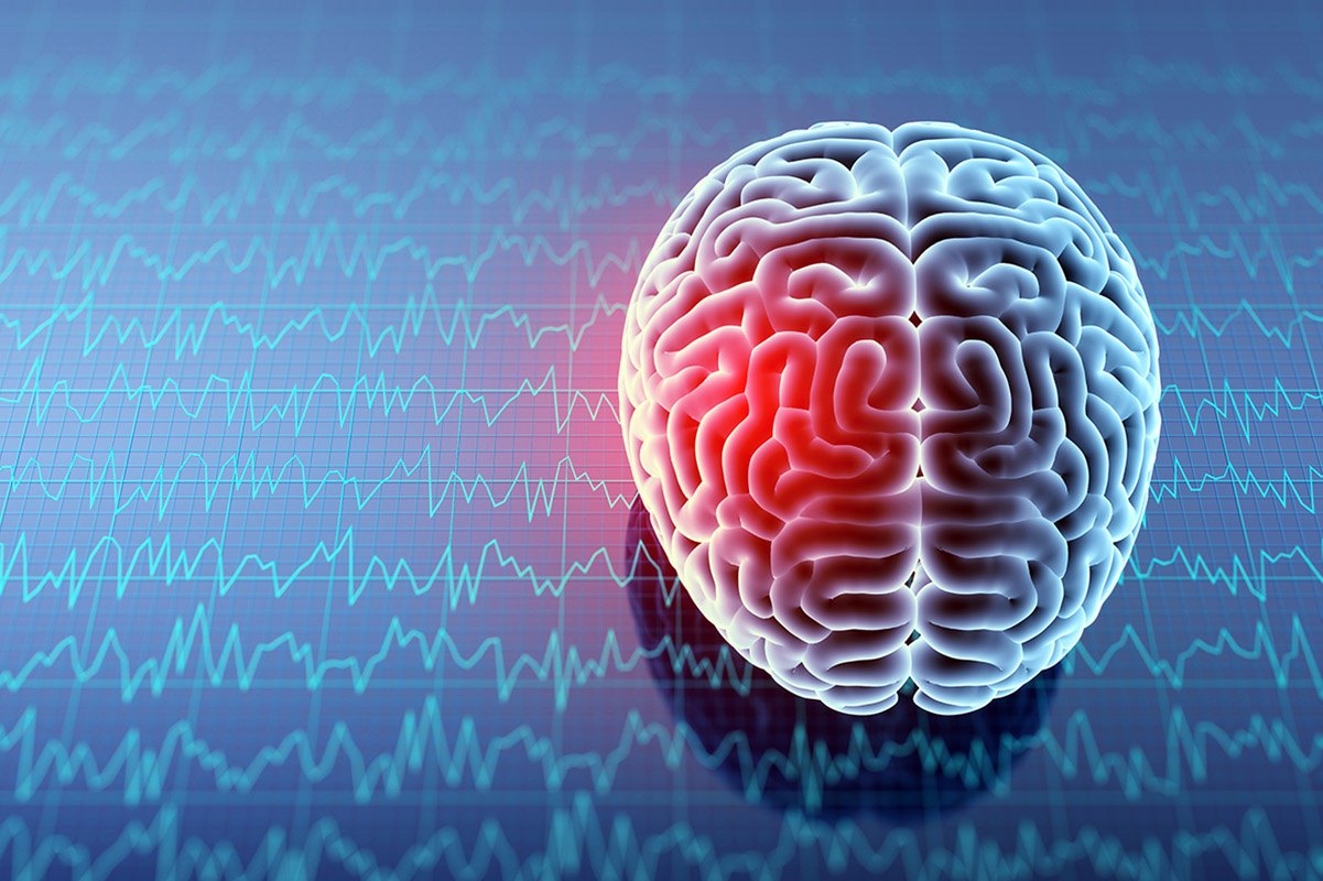 Brain & Spine Surgeons of New York