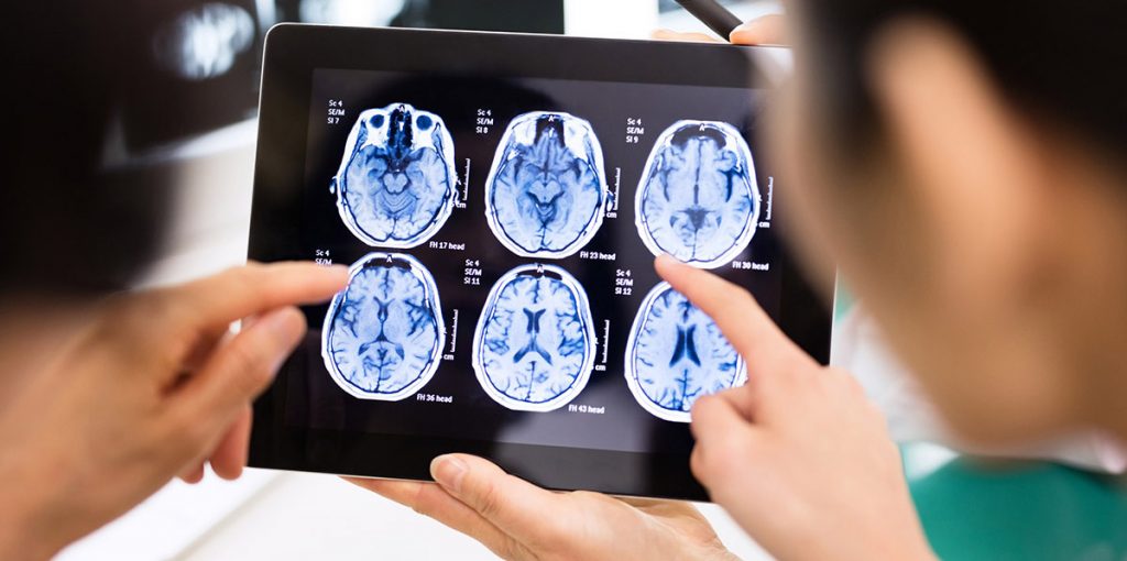 Functional Neurosurgery - Brain & Spine Surgeons of New York